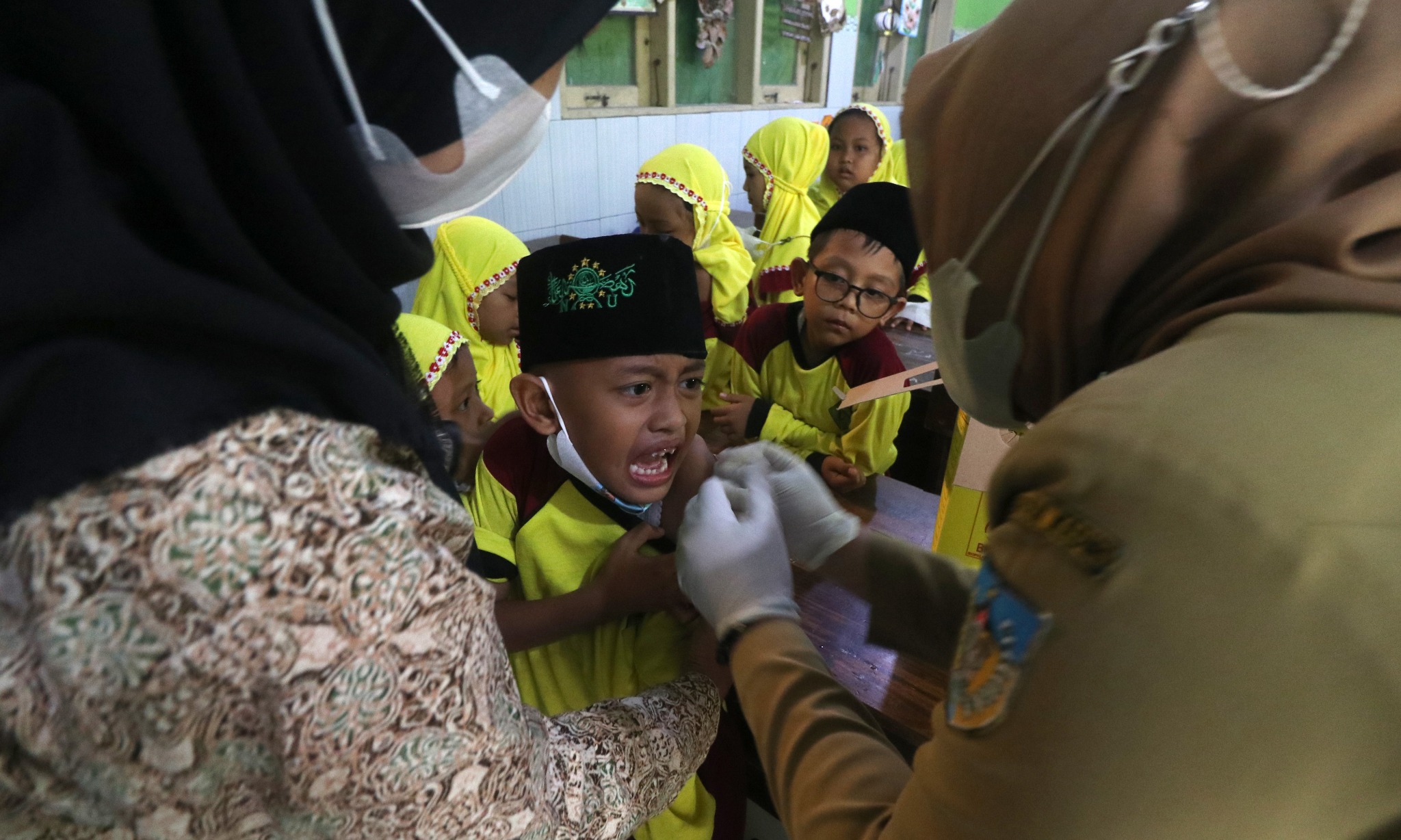 Campak, Diare Berat Hingga Kematian