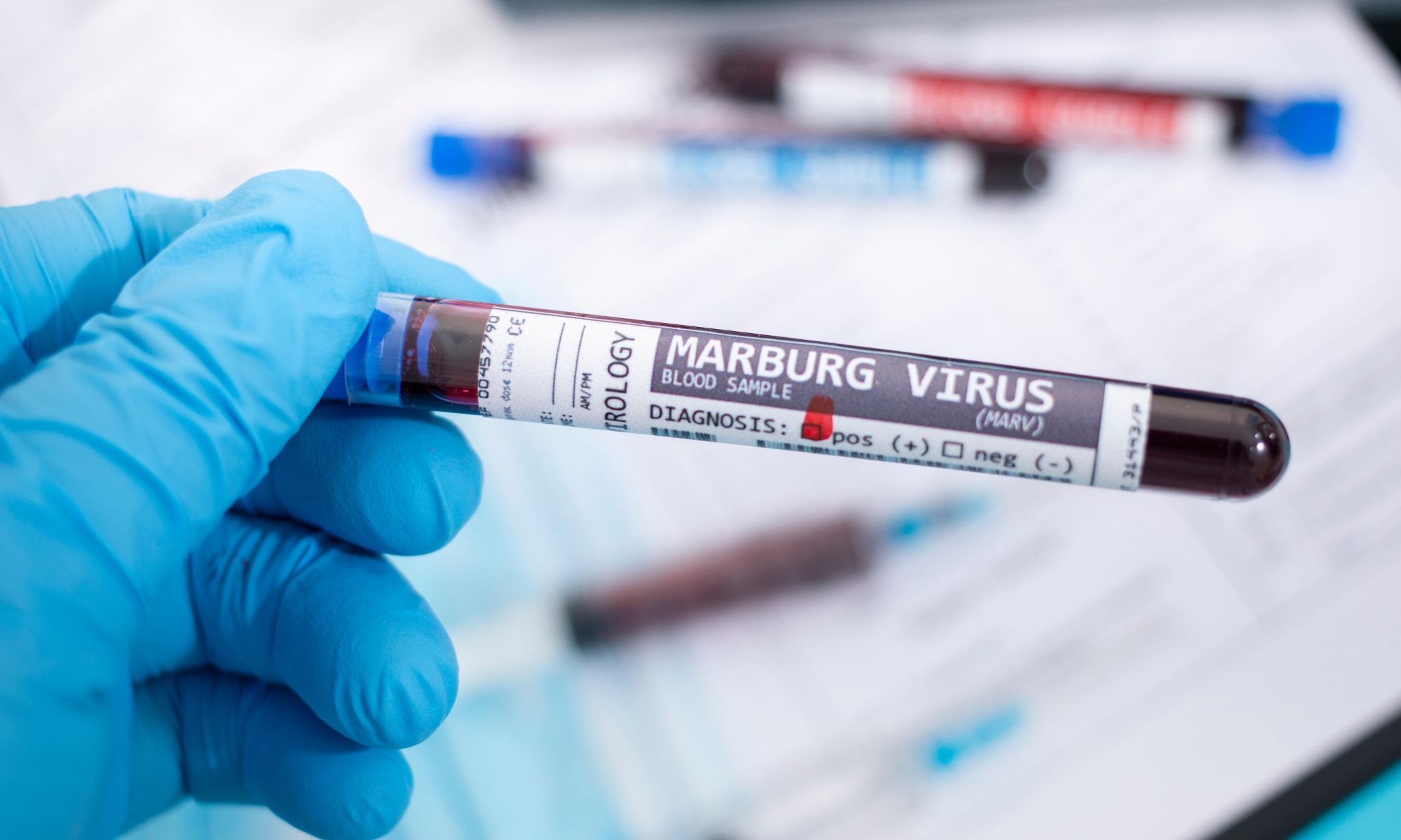 Masa Inkubasi Virus Marburg Bisa Capai 21 Hari