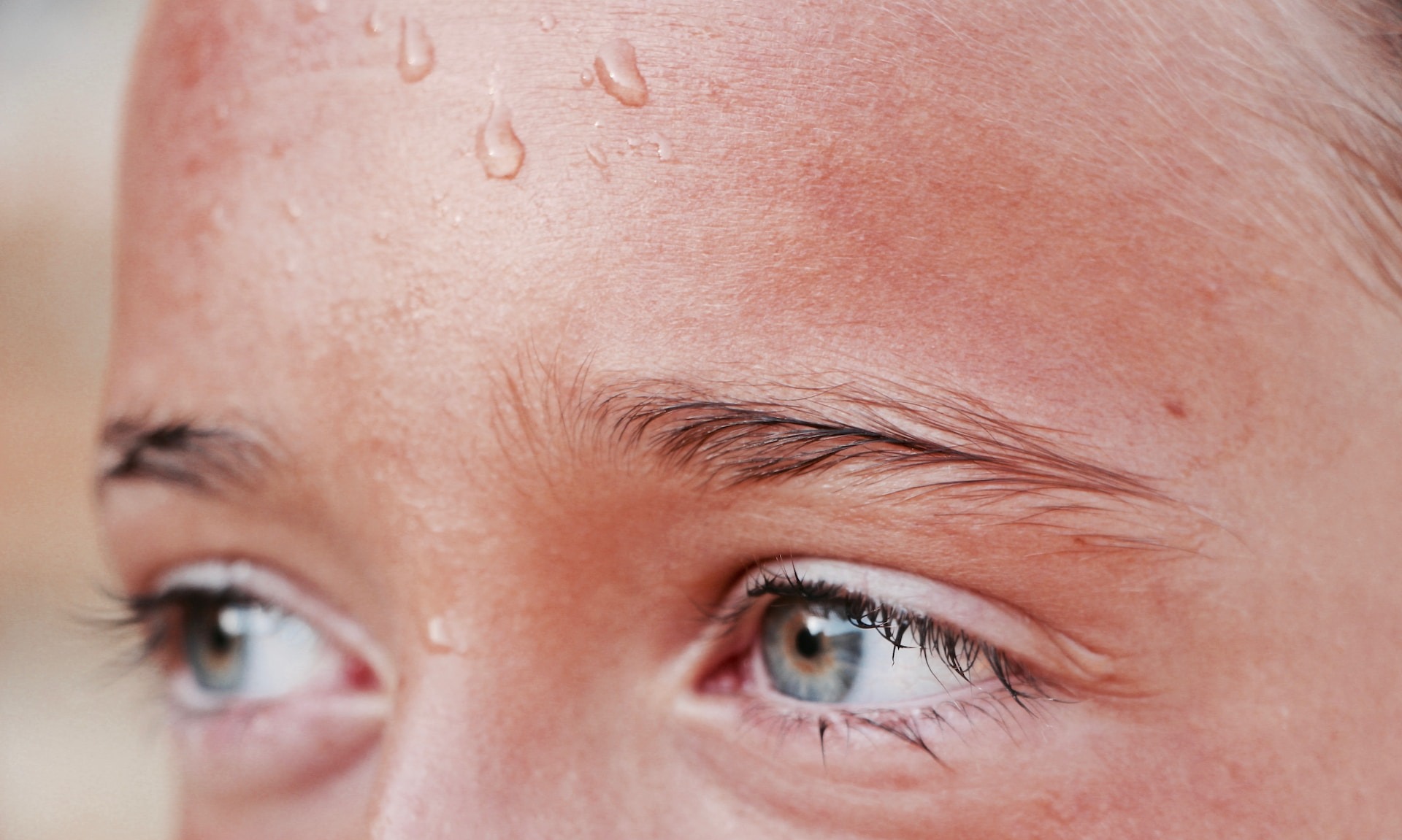 Mengenal Anhidrosis, Saat Tubuh Tidak Bisa Berkeringat