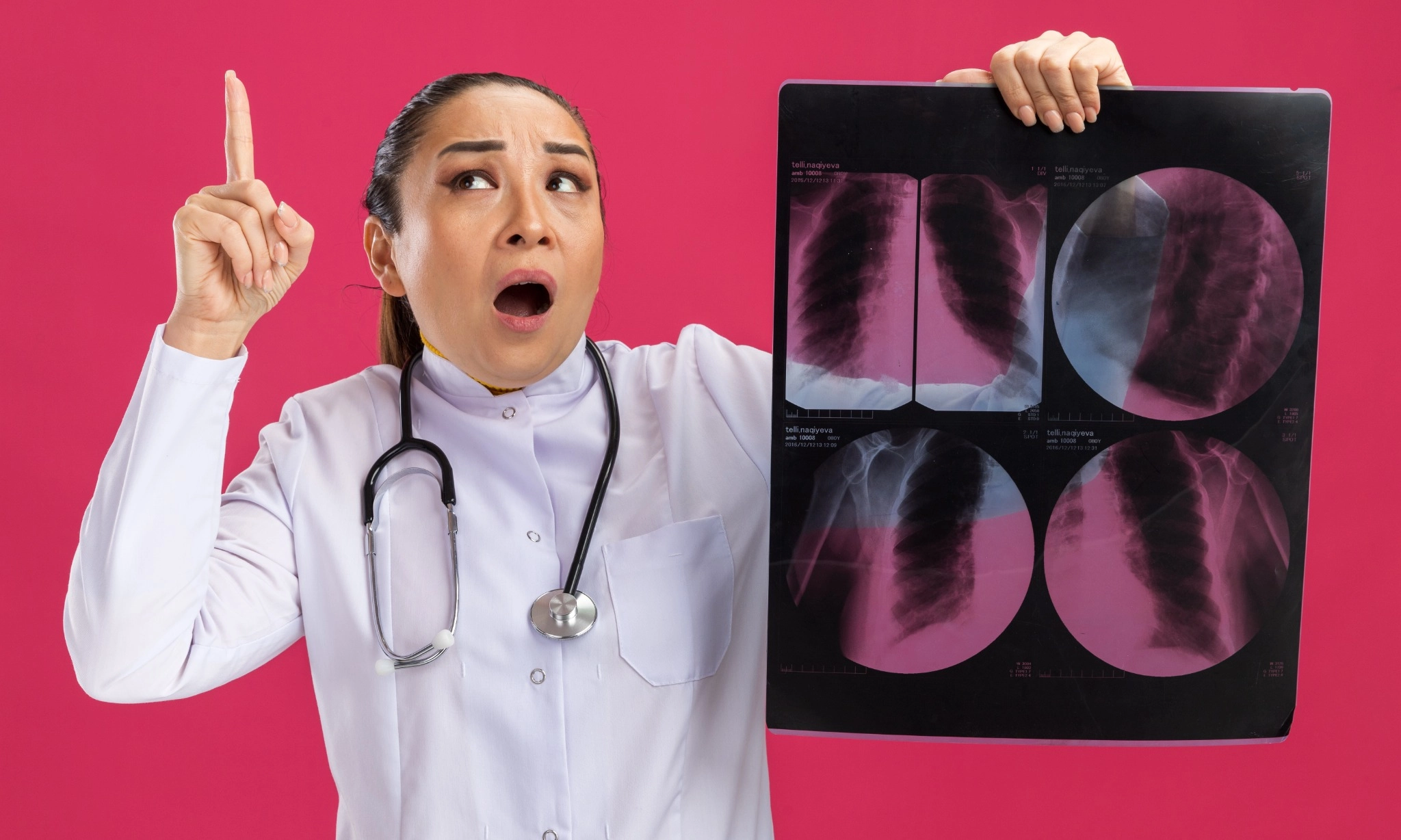 Kenali Gejala Penyakit Paru-paru Kolaps