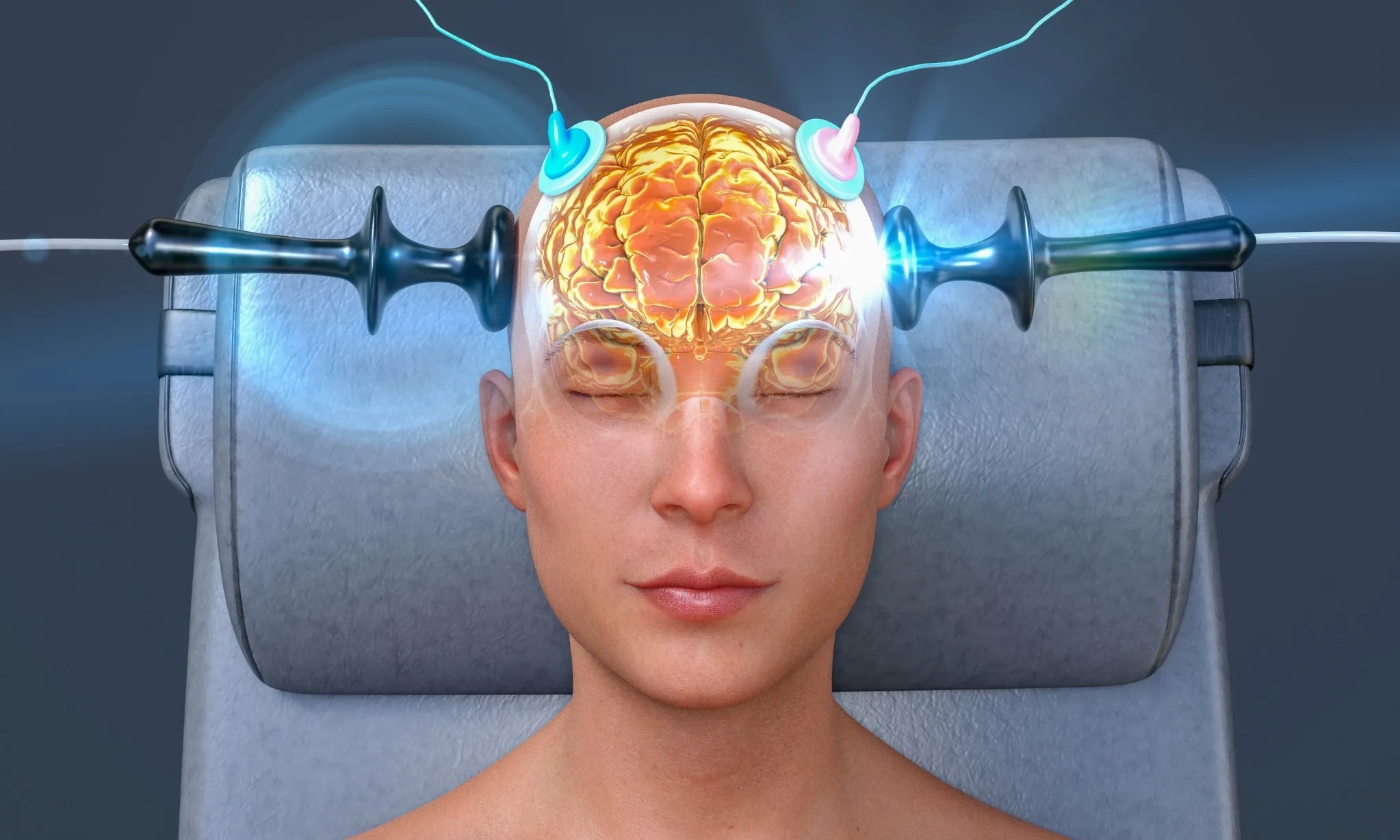 Mengenal Electroconvulsive Therapy (ECT)