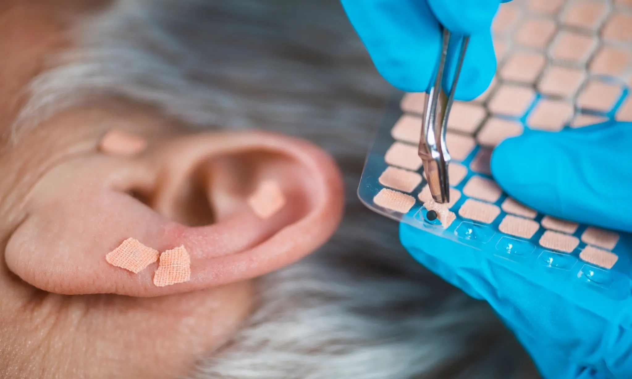 Fakta Di Balik Tren Ear Seed Secara Medis